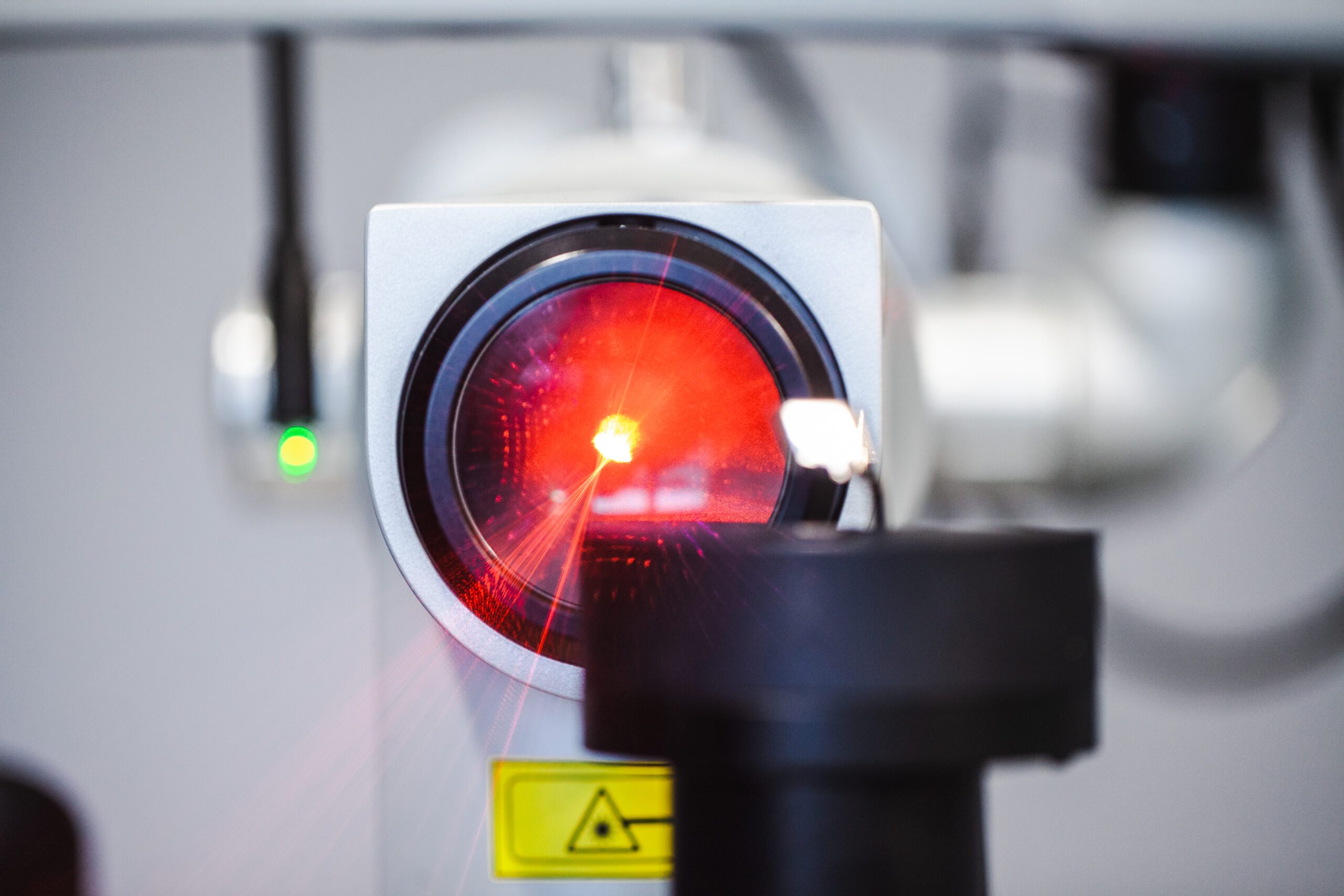 Selective laser trabeculoplasty | Beyondeye Eye Clinic