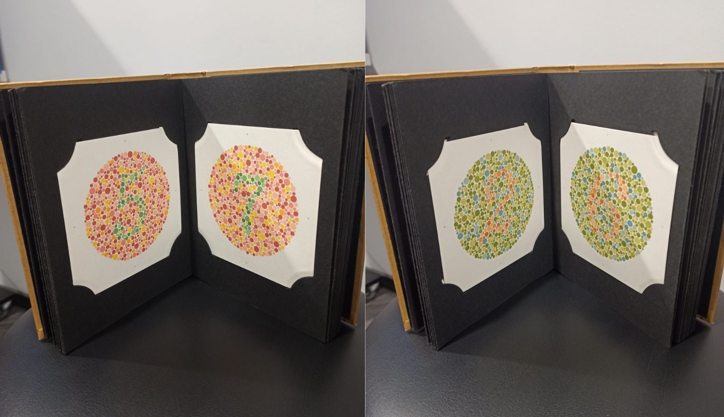 Farbsinnprüfung | Augenarztpraxis BeyondEye