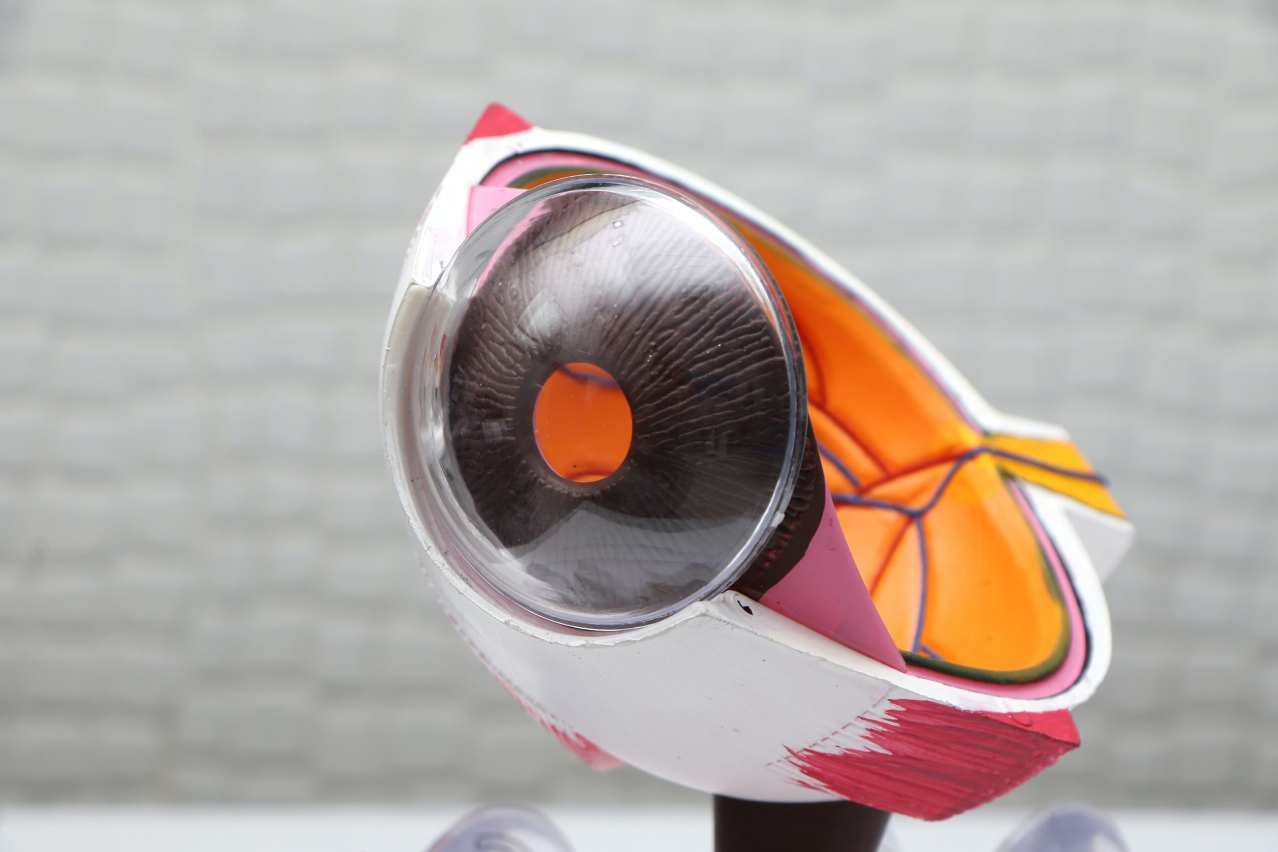 Vitrectomy | Beyondeye ophthalmology practice